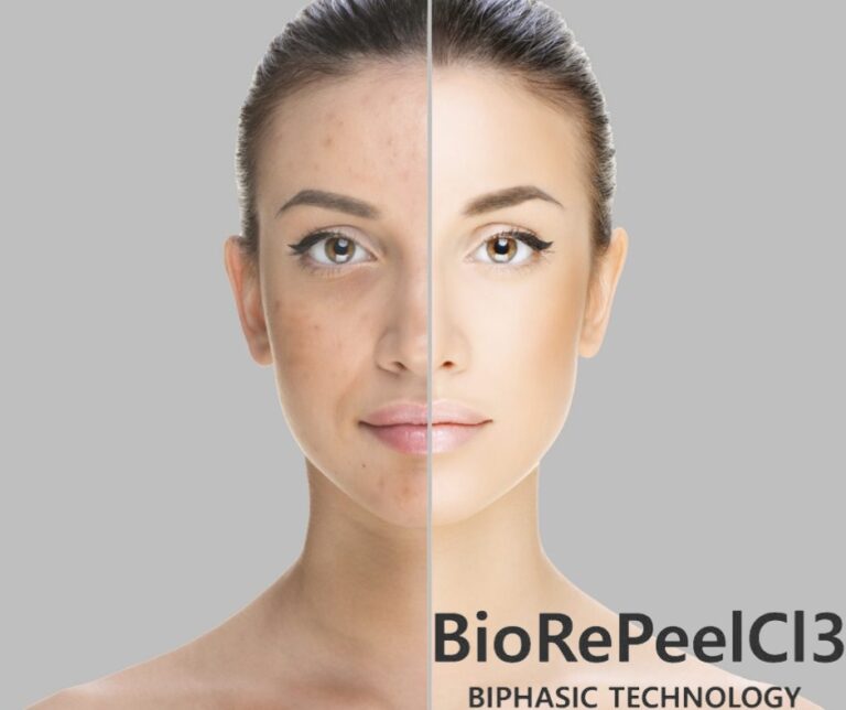 Transform Your Skin: Best BioRePeel Treatment in Leicester