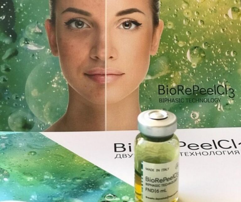 Transform Your Skin: Best BioRePeel Treatment in Leicester